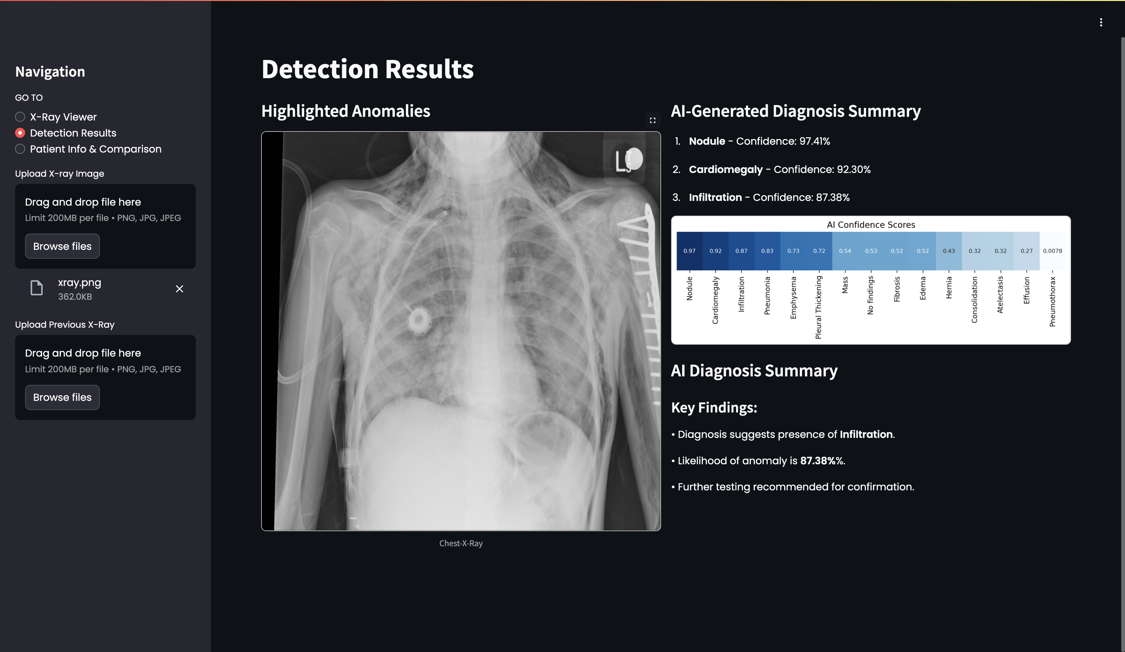 AI in Chest X-Rays: Using DenseNet-121 for Enhanced Diagnosis - Tech4Biz